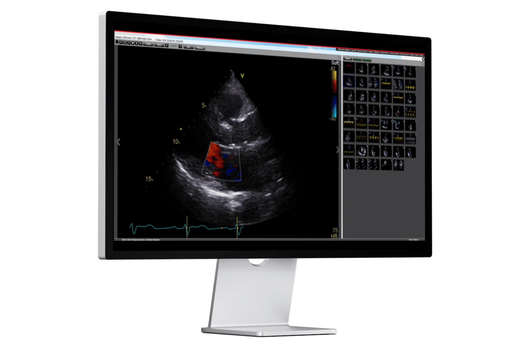 AccessPoint® Family of Products - Freeland Systems